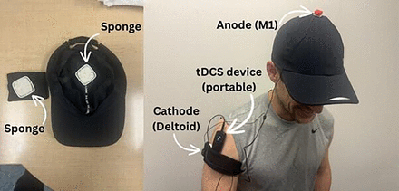 Anodal transcranial direct current stimulation (tDCS) modulates ...